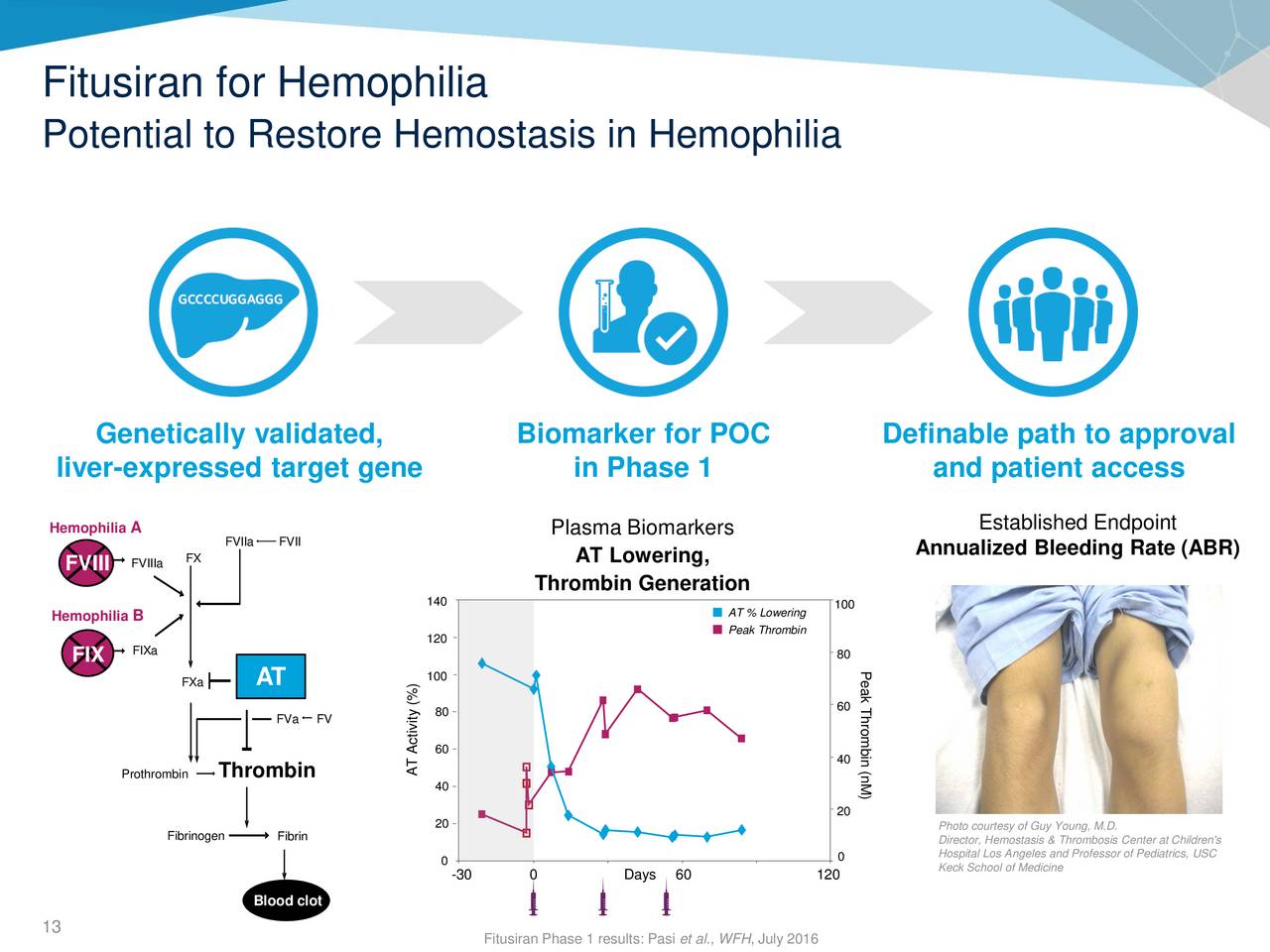 Alnylam Pharmaceuticals, Inc. 2017 Q2 - Results - Earnings Call Slides ...