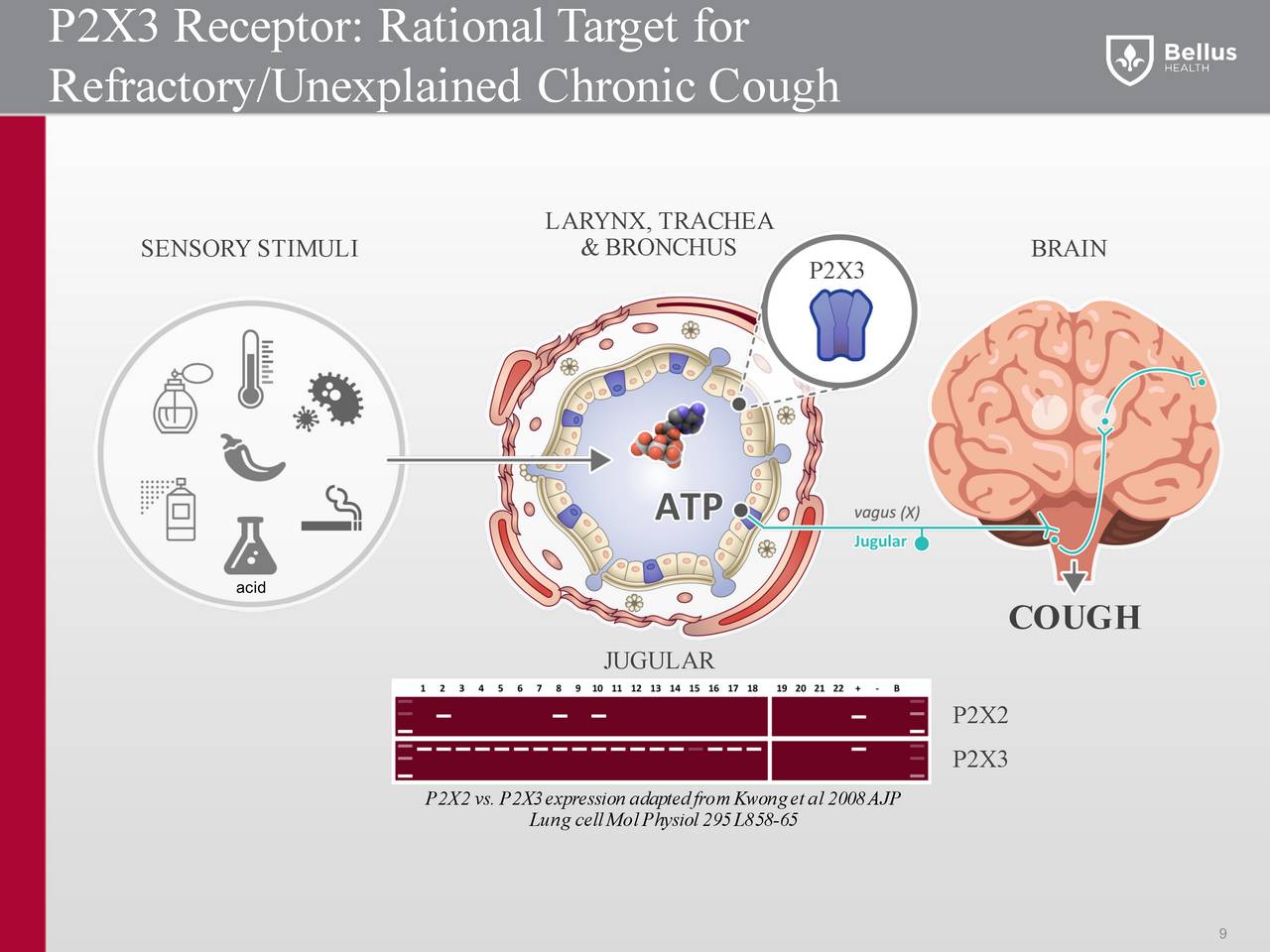 BELLUS Health (BLUSF) Updates On BLU-5937 & Chronic Cough Key Opinion ...
